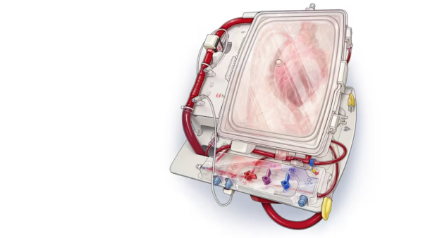 Michelle Gribilas shares how ‘dead heart’ transplant saved her – The ...